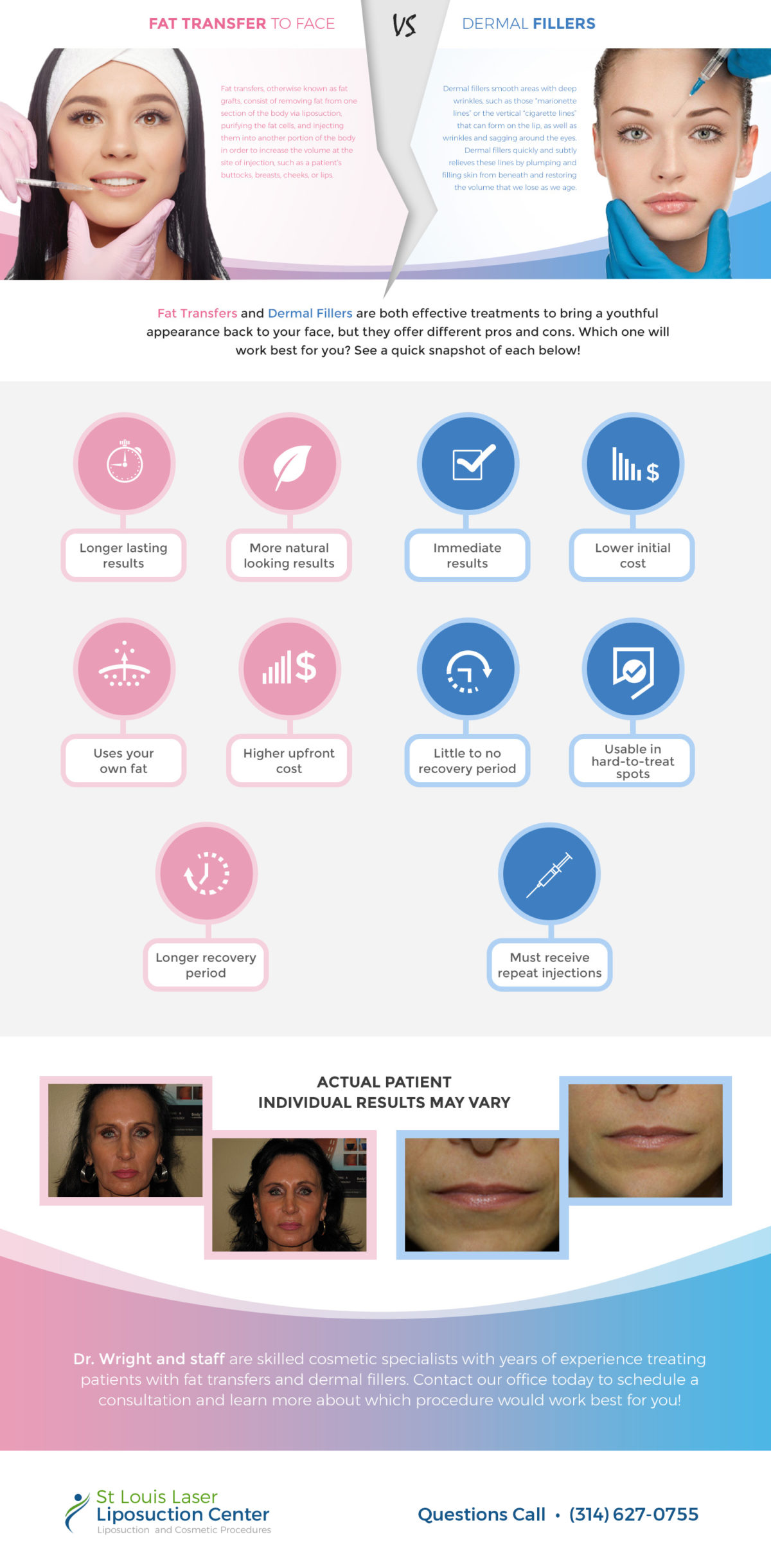 Fat Transfers and Facial Fillers in St Louis | St Louis Liposuction Center