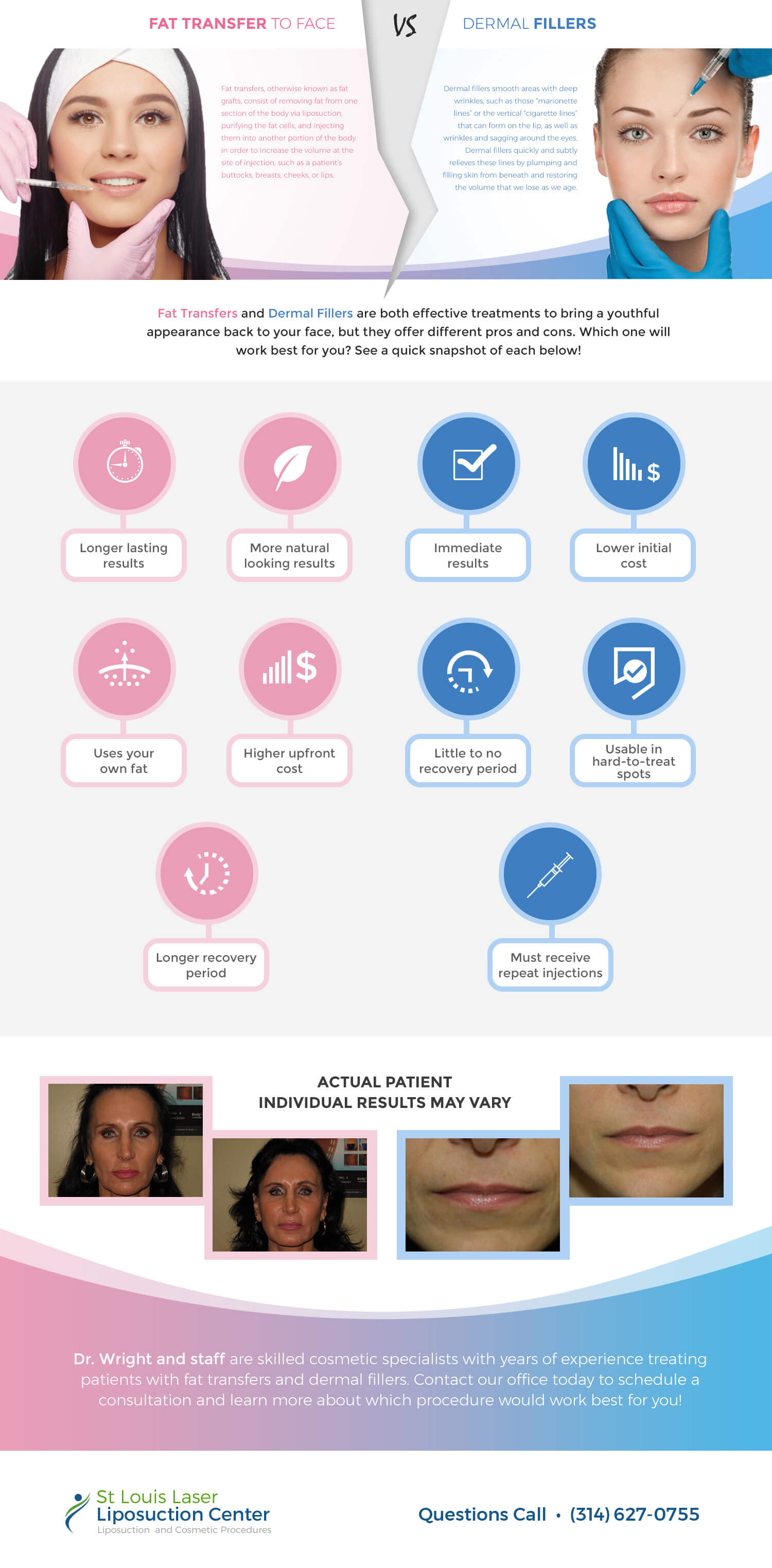 Fat Transfer Vs Dermal Fillers Sllc St Louis Lipo