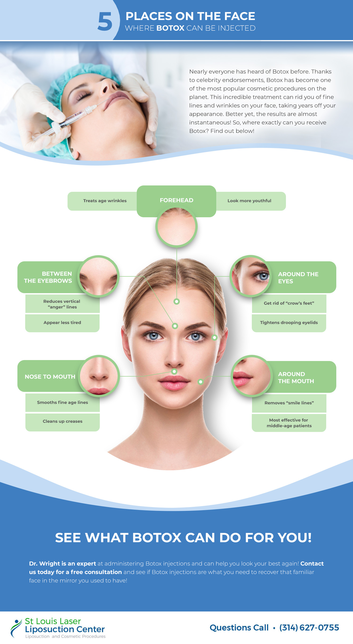 5 Places You Can Receive A Botox Injection | St Louis Liposuction Center