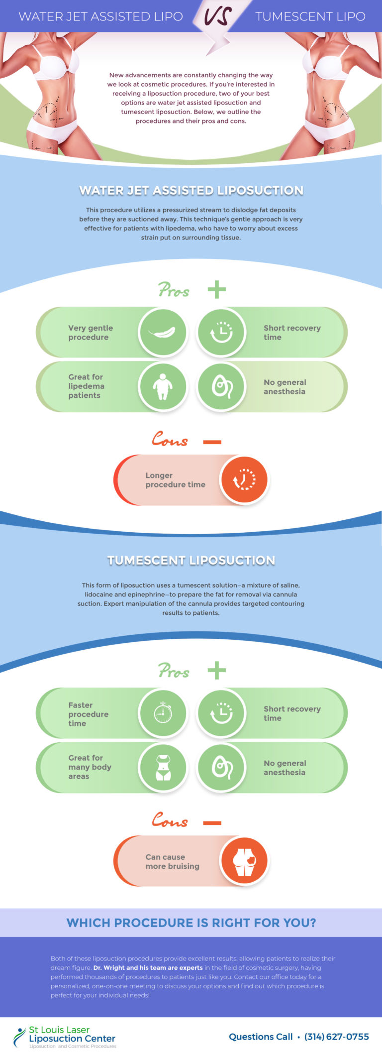 Learn About The Water Assisted Liposuction | St Louis Lipo