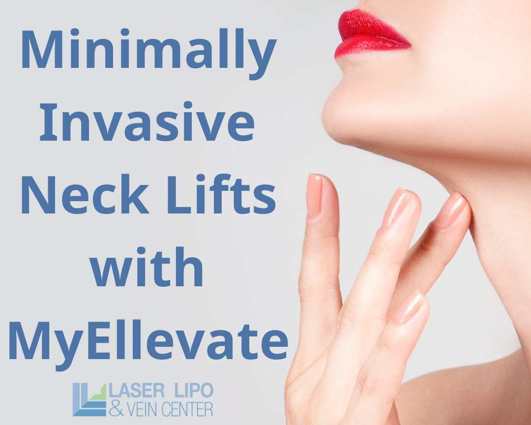 MyEllevate Neck Lift St Louis Laser Lipo and Vein - St Louis Lipo