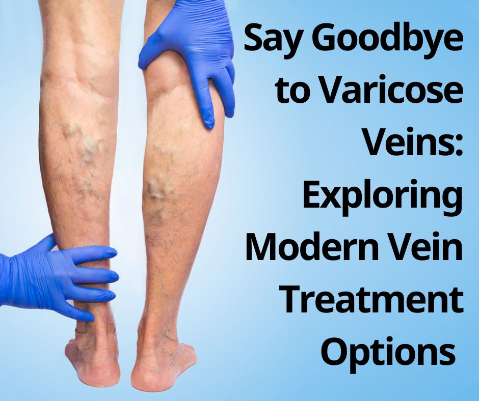 Varicose Veins VenaSeal Treatment New York Vein Treatment Center